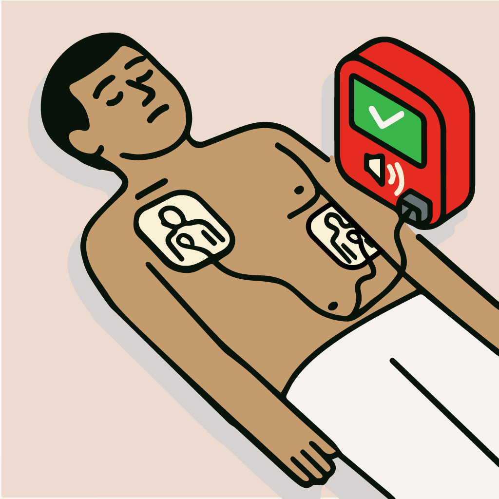 AED Pad Placement: A Guide for Adults, Children, and Infants · AED ...