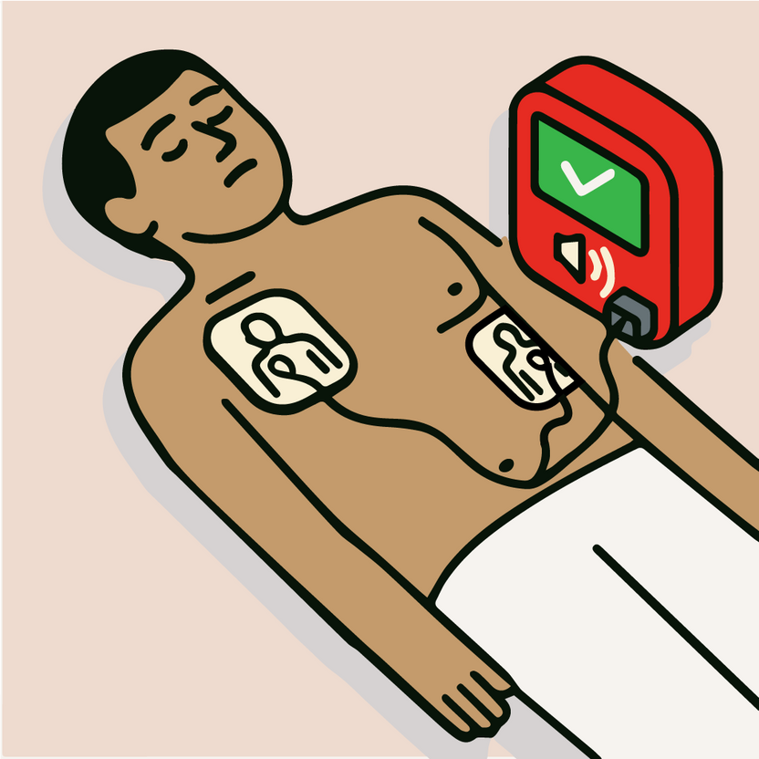 AED Pad Placement: A Guide for Adults, Children, and Infants · AED ...